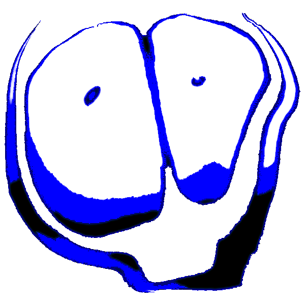 Sensitive content by Playapokl - Meme Sound Effect Button for ...